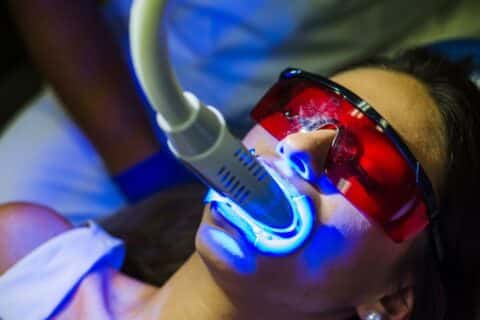 Teeth Whitening for Sensitive Teeth: Safe Options and Tips